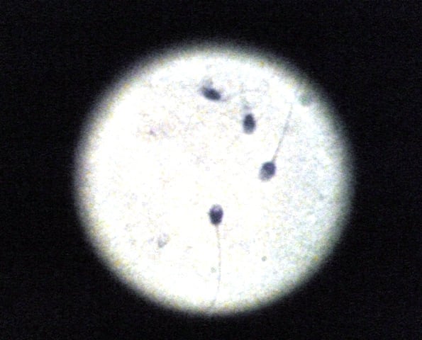 Espermograma Completo – Procedimento Rápido e sem Constrangimentos ...